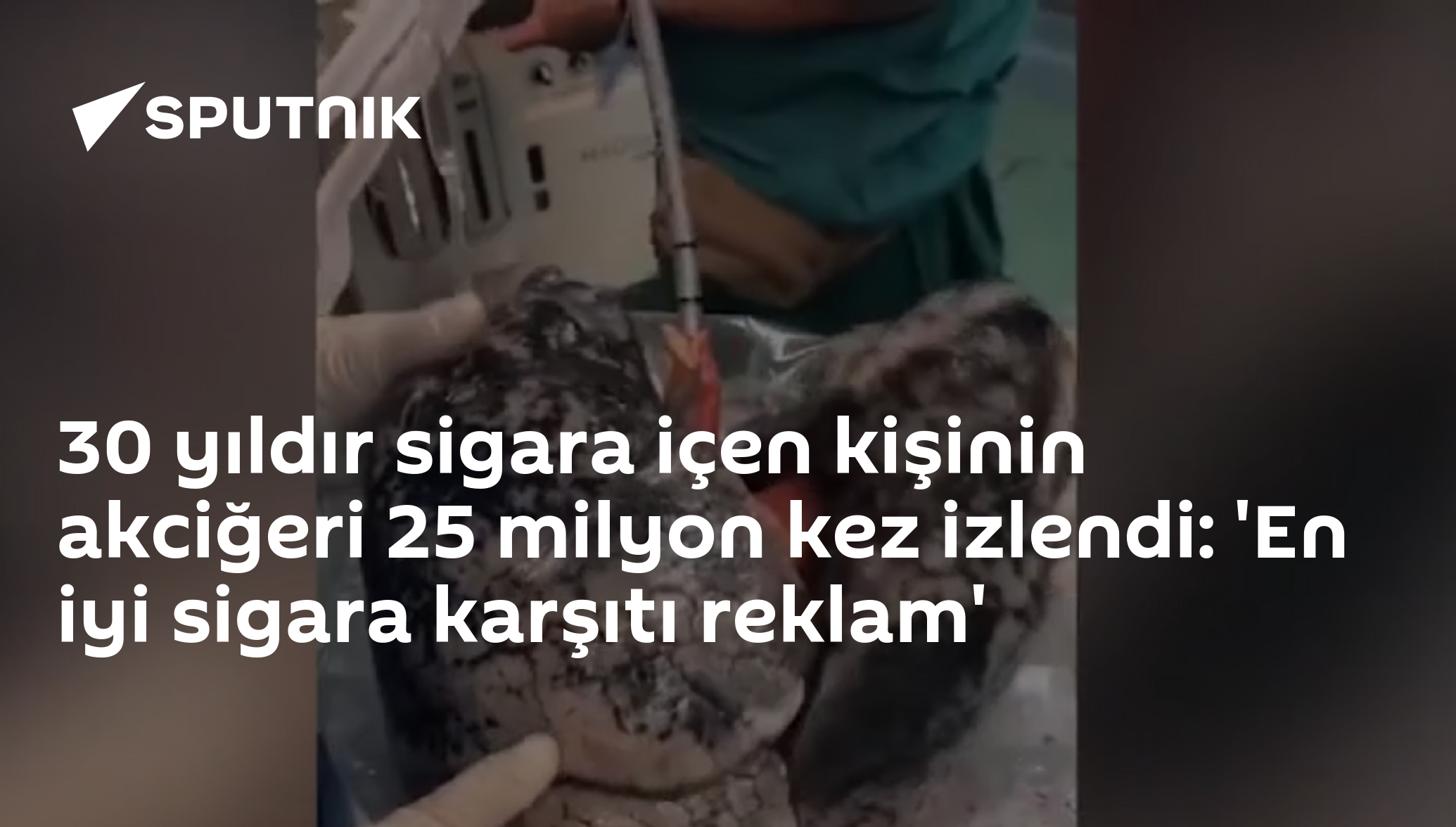 30 Yıldır Sigara Içen Kişinin Akciğeri 25 Milyon Kez Izlendi En Iyi